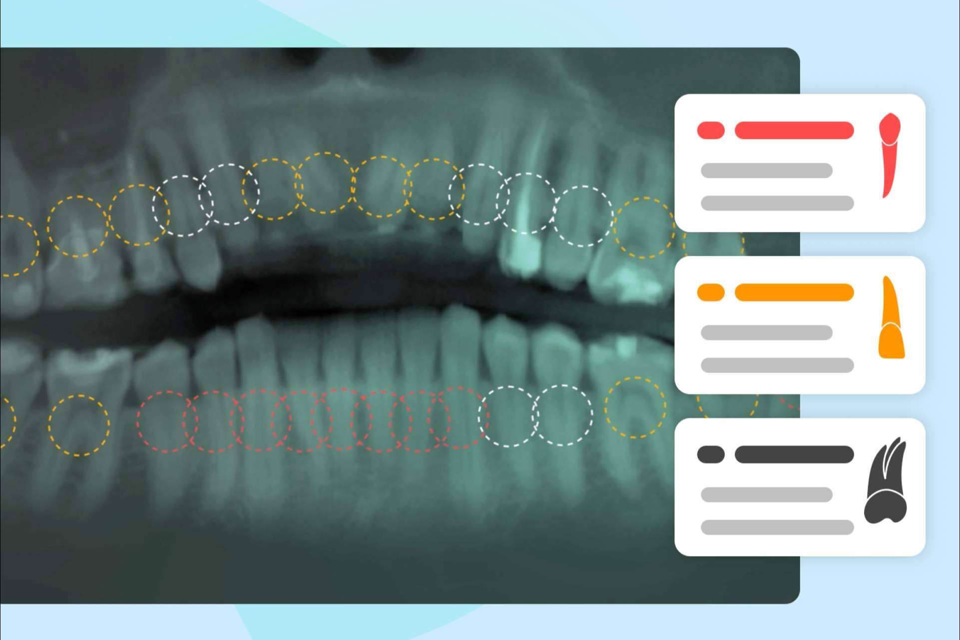 El software dental IA, de la mano de Dentomo